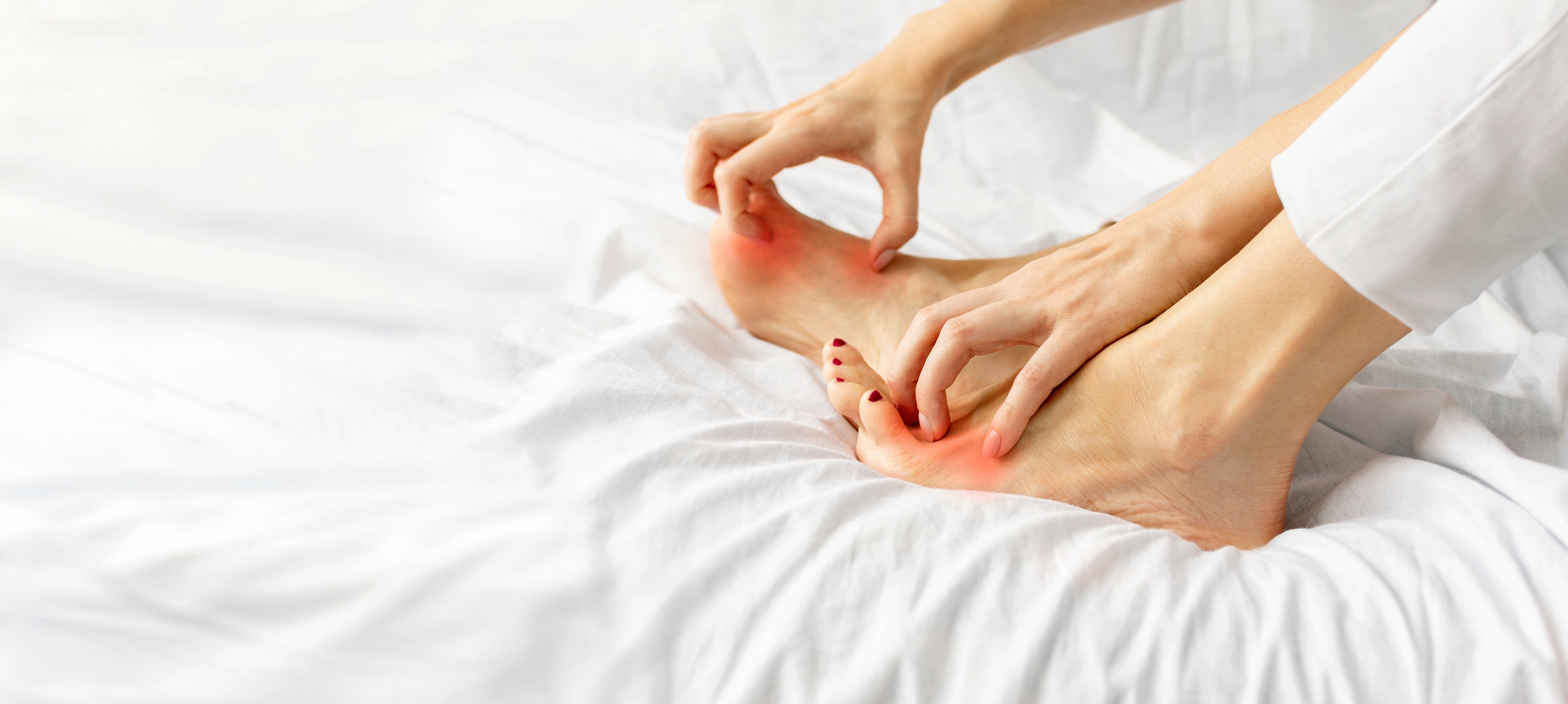 Foot eczema or fungal infection? Symptoms, causes and dyshidrosis